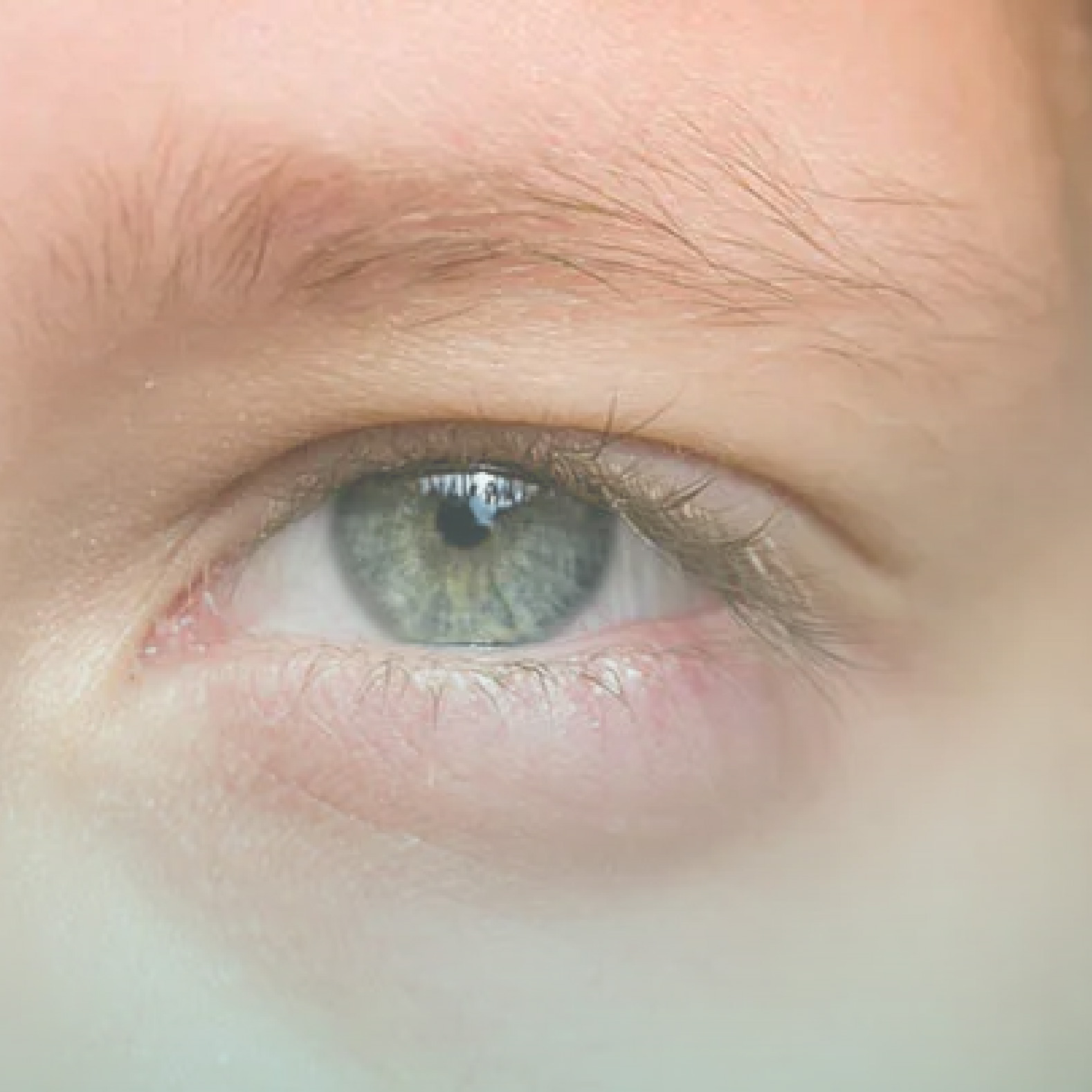 Swelling under the eye - Yugen Care