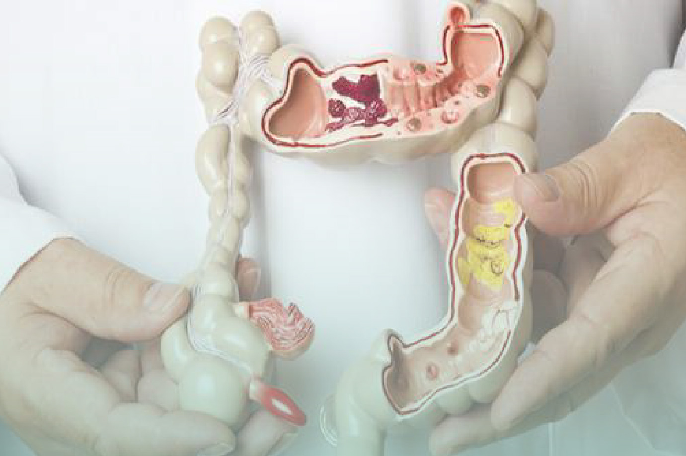 Anorectal Manometry- Anorectal Manometry Treatment- Yugen Care